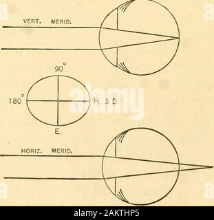 . The refraction of the eye; including a complete treatise on ...