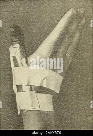 Modern surgery, general and operative . -ing above it. This proves ...