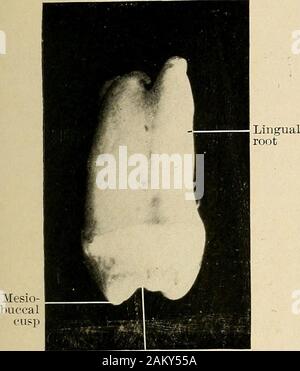 Principles and practice of operative dentistry . surmounted by four ...