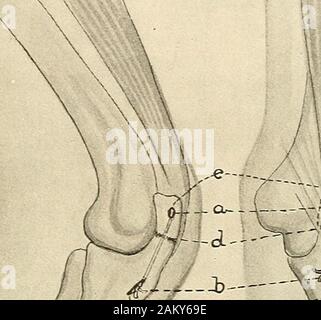 Modern surgery, general and operative . s and stiffness from traumatic ...