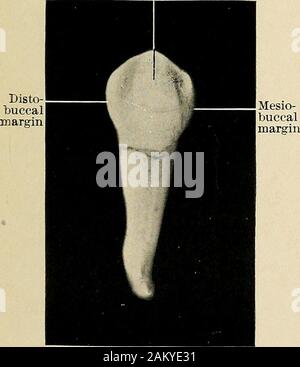 Principles and practice of operative dentistry . ridge ridge Lingual ...
