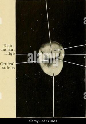 Principles and practice of operative dentistry . Mesio- buccal cusp ...