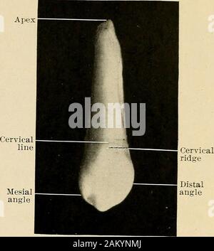 Principles and practice of operative dentistry . Disto-buecal cusp Fig ...