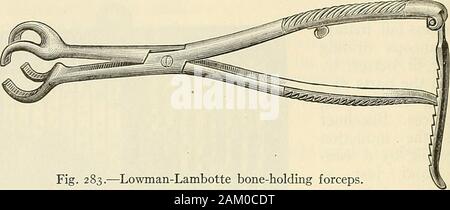 . Diseases of bones and joints . d tissue.Fibrous tissue, generally ...