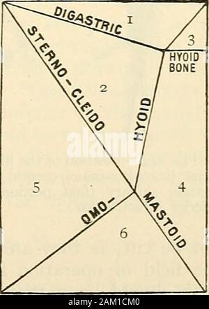 Modern surgery, general and operative . es, are angled, nodular,fiirm ...