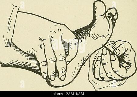 . Medical and surgical therapy. Fig. 16.—Normal plantar cutaneous ...