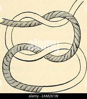 Modern surgery, general and operative . middle and outer thirds of ...