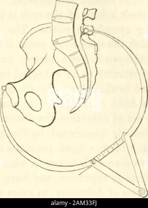 . Obstetrics: the science and the art. DEFORMED PELVIS. 523 ference of ...