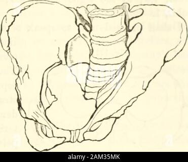 . Obstetrics: the science and the art. DEFORMED PELVIS. 523 ference of ...