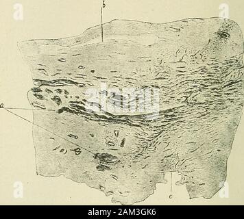 . Medical and surgical therapy. Fig. 14.. Fig. 15. Figs. 13, 14 and 15 ...