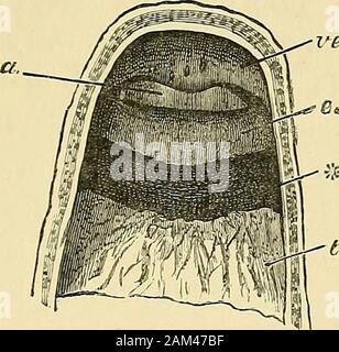 On stertor, apoplexy, and the management of the apoplectic state ...