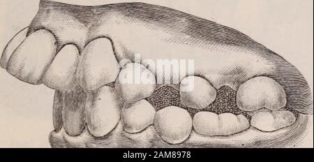 Different jaws models Stock Photo - Alamy