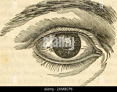 . A treatise on the diseases of the eye. of the subject, see Archiv ...
