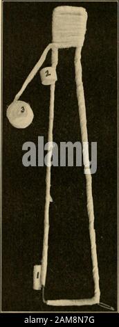 The treatment of fractures . Line of fracture. Fig. 559.—Fracture of ...