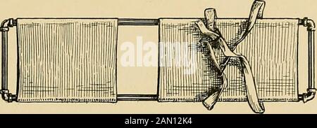 The treatment of fractures . Fig. 426.—The Cabot wire splint ready for ...