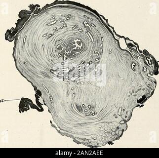 Gynaecology for students and practitioners . INFLAMMATION OF THE ...