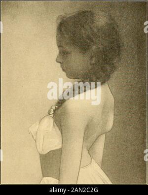 . Medical diseases of infancy and childhood. Fig. 67, Mongolian Idiot ...