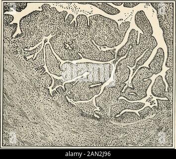 Gynaecology for students and practitioners . INFLAMMATION OF THE ...