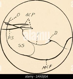 Roentgen diagnosis of diseases of the head . MCF Fig. 35.—A type of ...