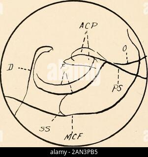 Roentgen diagnosis of diseases of the head . MCF Fig. 35.—A type of ...