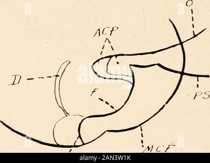 . Roentgen diagnosis of diseases of the head . AICF Fig. 35.—A type of ...