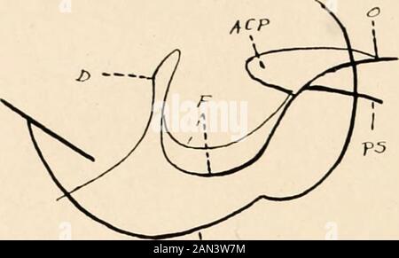 . Roentgen diagnosis of diseases of the head . AICF Fig. 35.—A type of ...