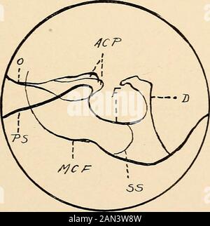 Roentgen diagnosis of diseases of the head . MCF Fig. 35.—A type of ...
