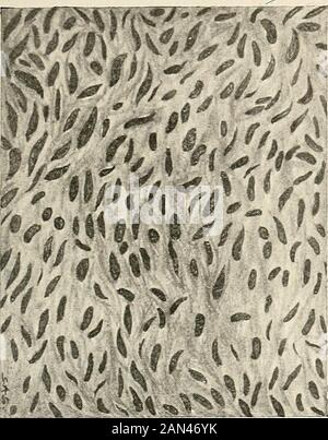 Gynaecology for students and practitioners . Fig. 227. Sakcomatou ...