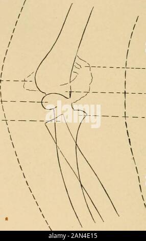 The treatment of fractures . Epiphysis. Shaft of humerus. Ulna. Fig ...