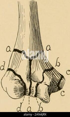 The treatment of fractures . Epiphysis. Shaft of humerus. Ulna. Fig ...