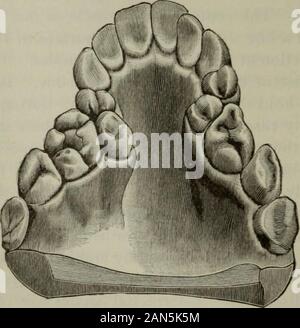 The Dental cosmos . MOUTH-BREATHING, ETC. 933 While the jaw is not ...