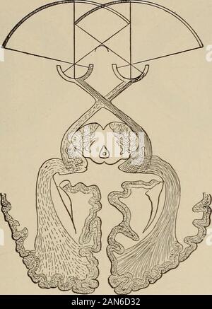 Nervous and mental diseases . Left. Right, Fig. 30.—Blindness in both ...