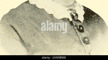 A history of the Allerton family in the United States : 1585 to 1885 ...