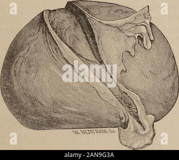 Chicago medical journal and examiner . Figure 1. Antero-posterior ...