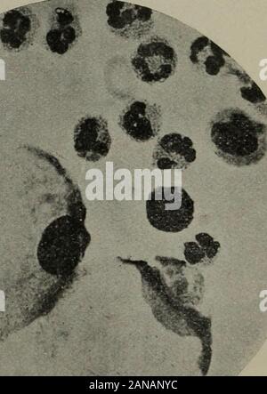 Medical communications of the Massachusetts Medical Society . Case 1 ...