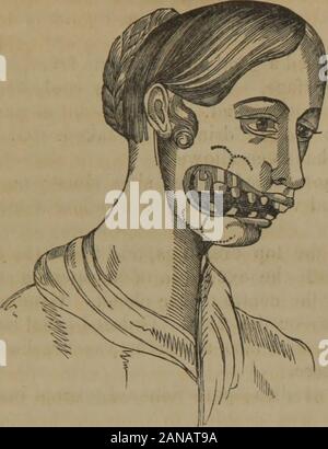 Lectures on the operations of surgery : and on diseases and accidents ...