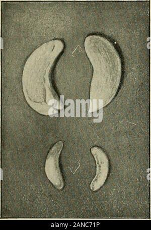 Chirurgie der Thymusdrüse . Fig. 15. Scliließliclie Atrophie der Hoden ...