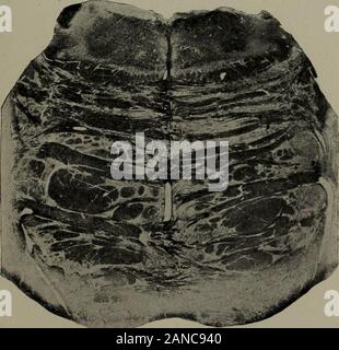 Medical communications of the Massachusetts Medical Society . Case 1 ...