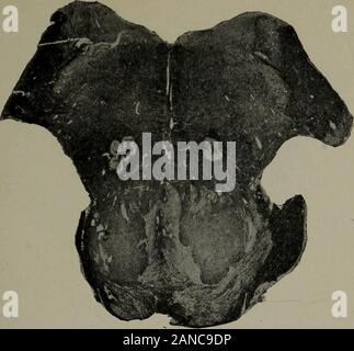 Medical communications of the Massachusetts Medical Society . Case 1 ...