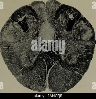 Medical communications of the Massachusetts Medical Society . Case 1 ...