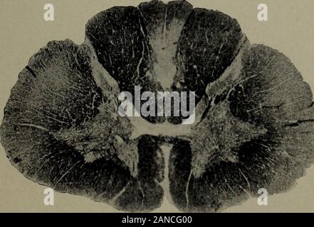 Medical communications of the Massachusetts Medical Society . Case 1 ...