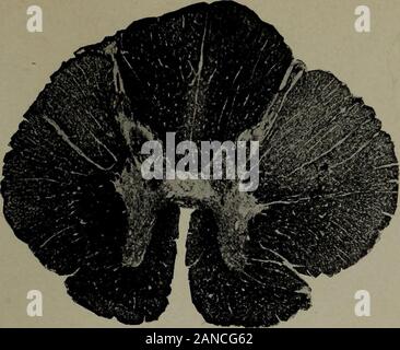 Medical communications of the Massachusetts Medical Society . Case 1 ...