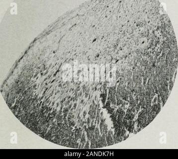 Skin tissue and hair follicles. Light micrograph of a section through ...