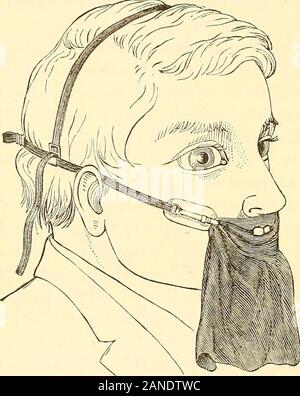 Principles and practice of operative dentistry . I. Simple Cavities ...