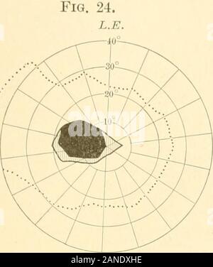The toxic amblyopias: their classification, history, symptoms ...