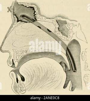Suborbital Ridges Toe