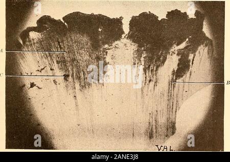 Principles and practice of operative dentistry . Deciduous inferior ...