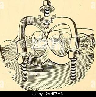 Principles and practice of operative dentistry . Parr separator. Perry ...