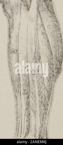 Head and neck muscles. Lateral view of the superficial muscles of the ...