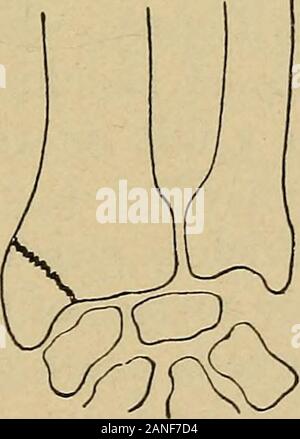 Atlas and epitome of traumatic fractures and dislocations . (Fig. la ...